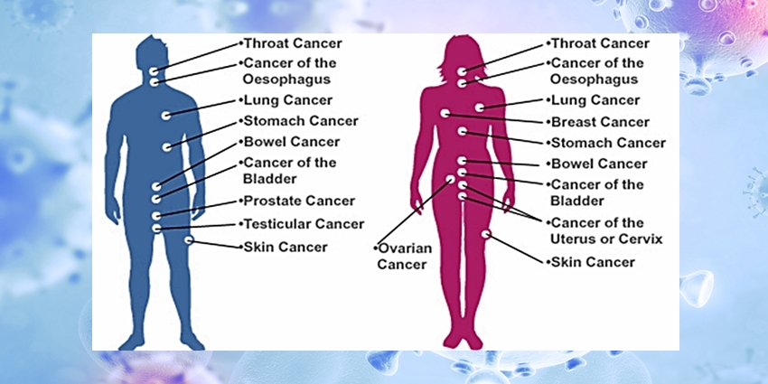 Types of cancer – Target Radiology