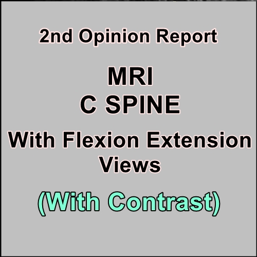 MRI C Spine with Flexion Extension (With Contrast) – Target Radiology