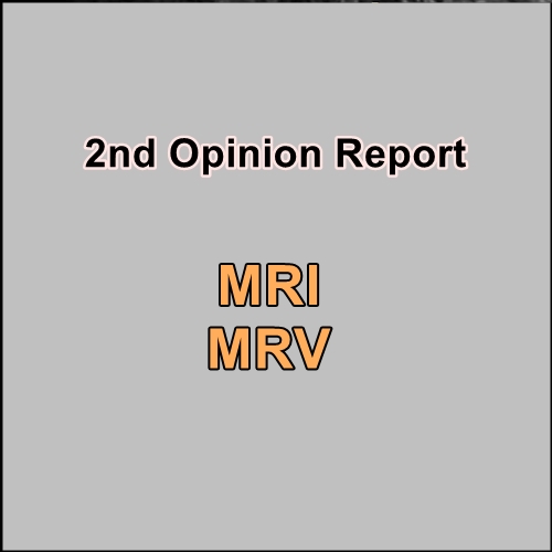 MRI MRV – Target Radiology